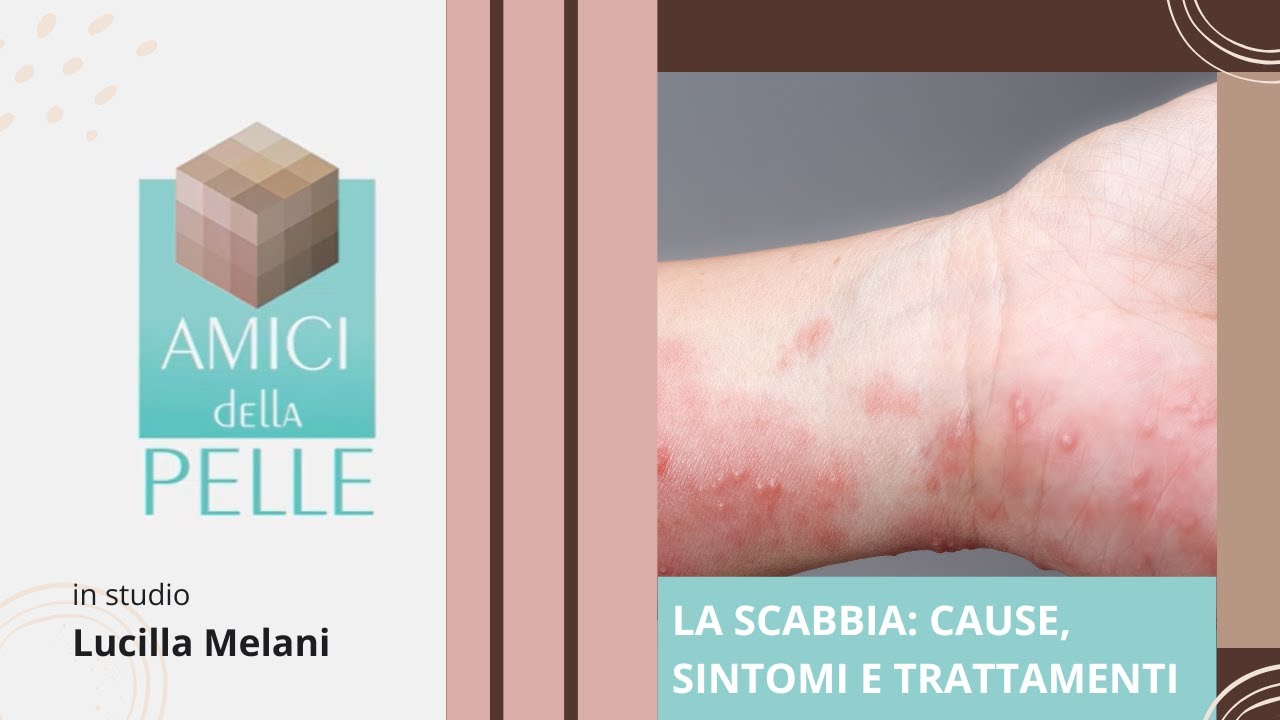 Foto scabbia: 7 segnali da non ignorare nel 2025